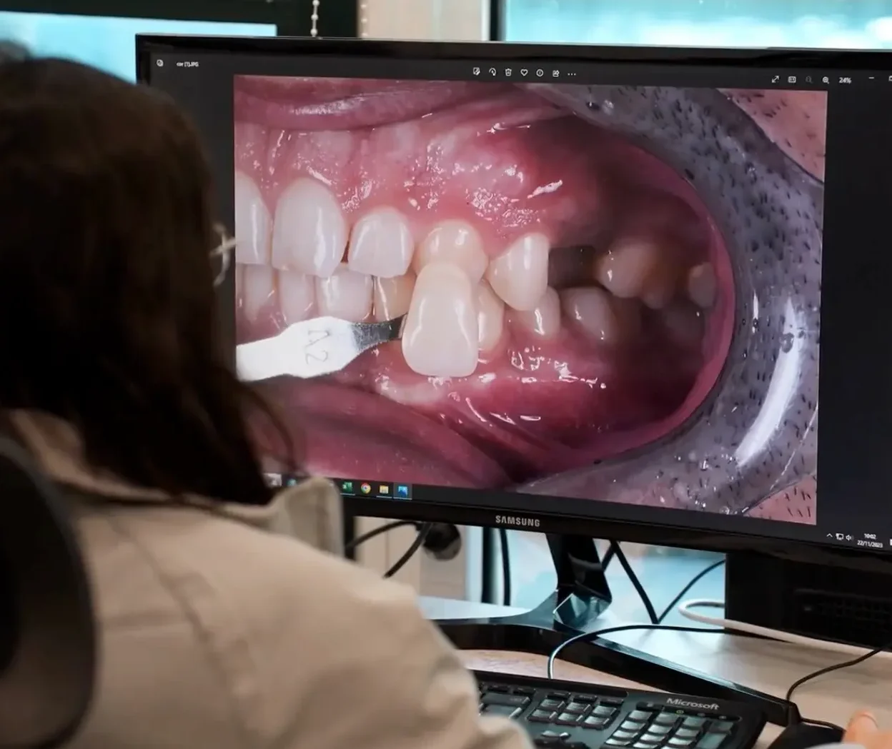 Implant Dentistry - White Clinic Implant Dentistry - White Clinic